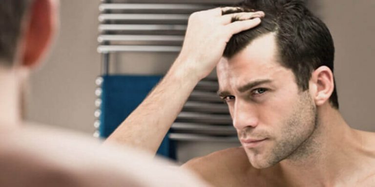 Can Low Testosterone Cause Hair Loss? – Treatments & Medications